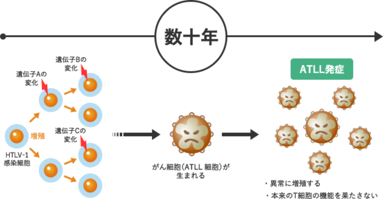 【疾患編】成人T細胞白血病リンパ腫（ATLL/ATL）とは | 検査・診断・治療 | りんぱしゅ通信 | ブリストル・マイヤーズ スクイブ株式会社